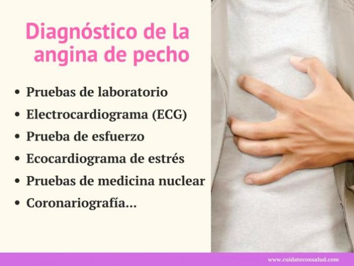 ¿Qué Es La Angina? , Angina de pecho: qué es, síntomas, tipos y ...
