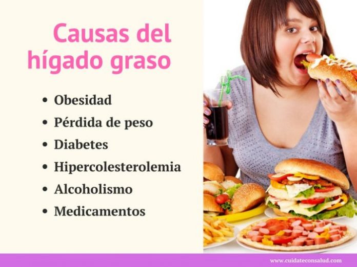 Hígado Graso ⇒ 【↓Síntomas, Causas y Tratamiento↓】