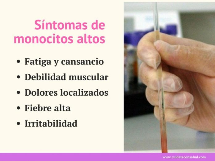 Monocitos Altos en Sangre ⇒ 【↓Síntomas y Tratamiento↓】