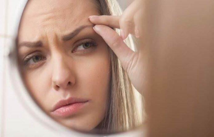 Parpados Hinchados ⇒ 【↓Tratamiento y Remedios↓】 ⚡️