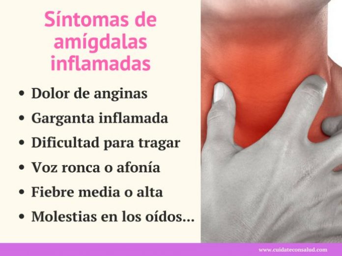 10 Remedios Caseros para las Amígdalas Inflamadas