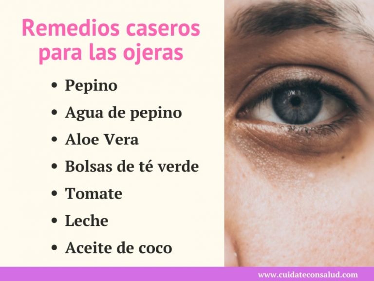6 Remedios Caseros para Quitar las Ojeras ⇒ 【Guía】?