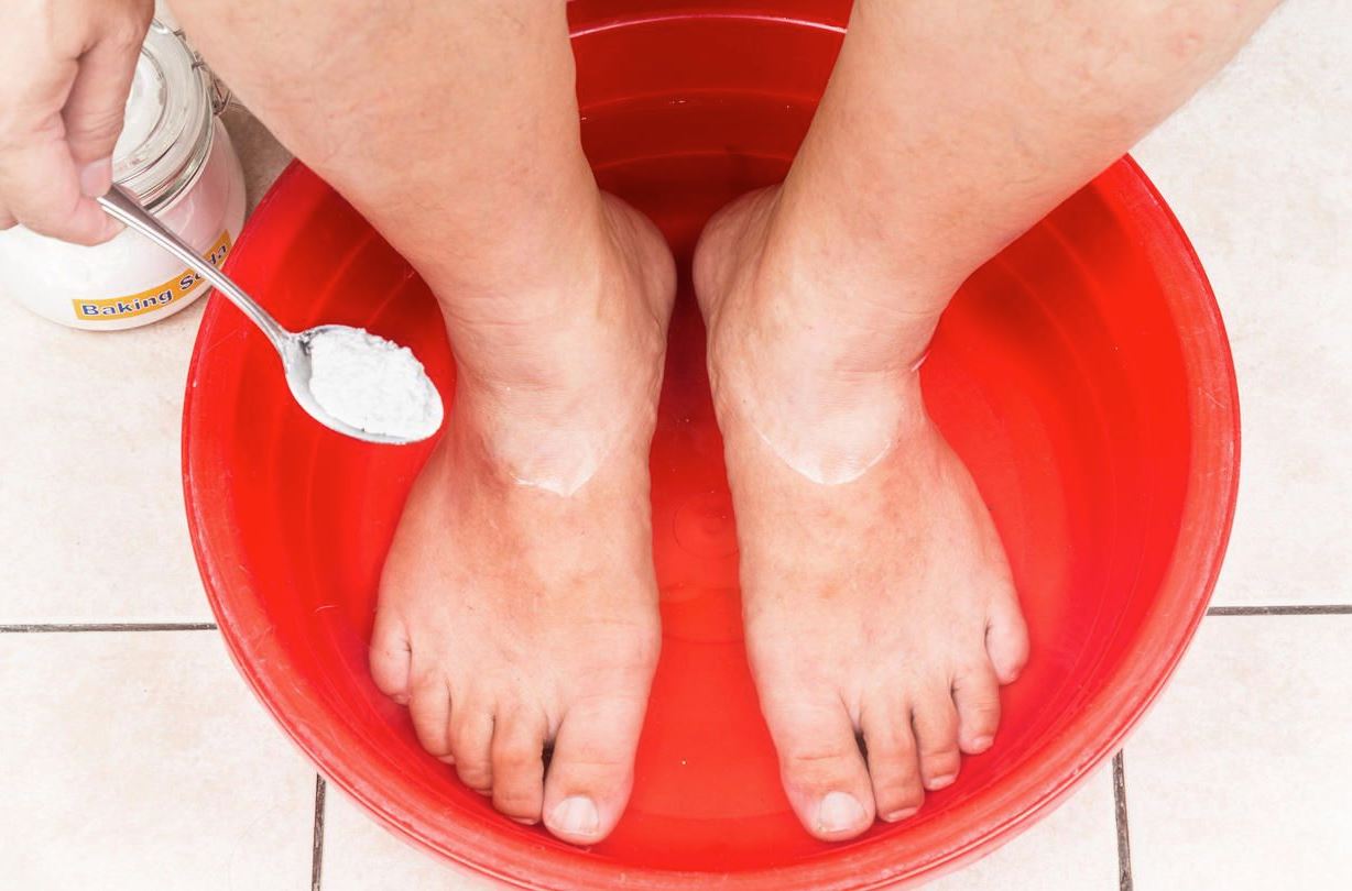 Remedios Caseros para Quitar los Callos de los Pies